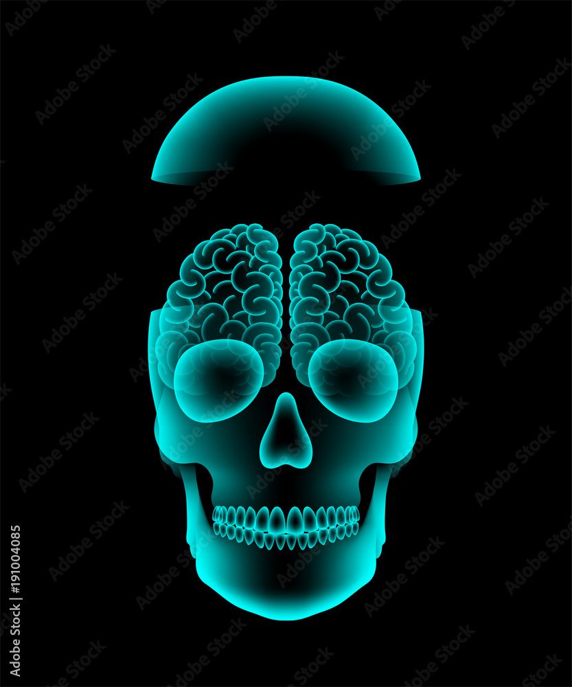 X Ray Brain Front