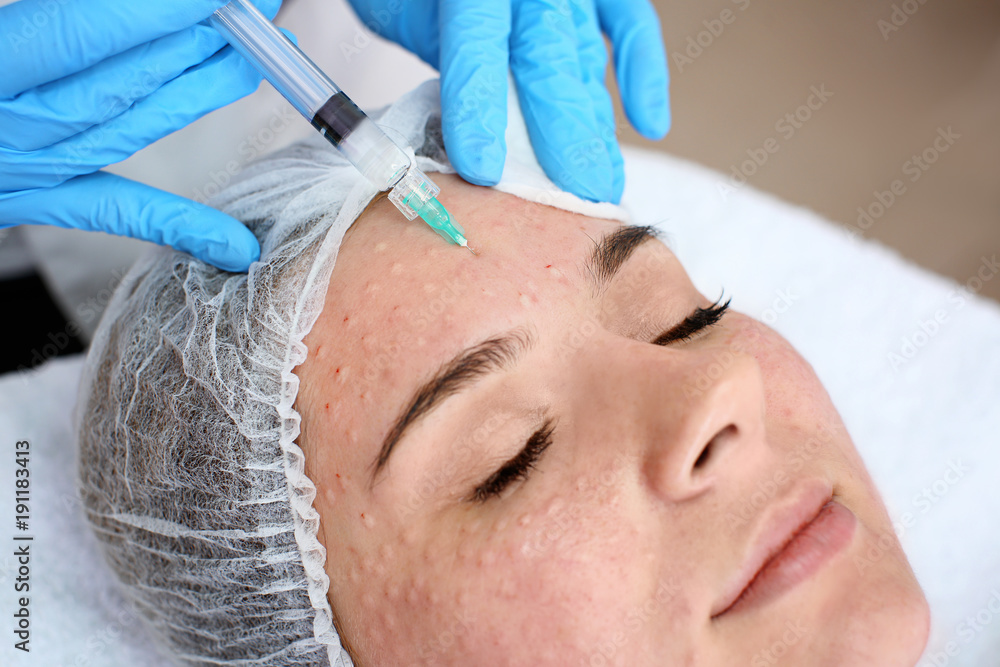 Beautician making injection in woman's face, closeup. Biorevitalization ...