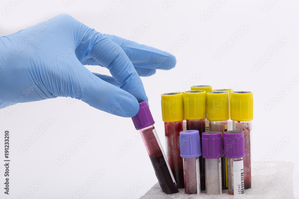 blood test tubes white background Stock Photo | Adobe Stock