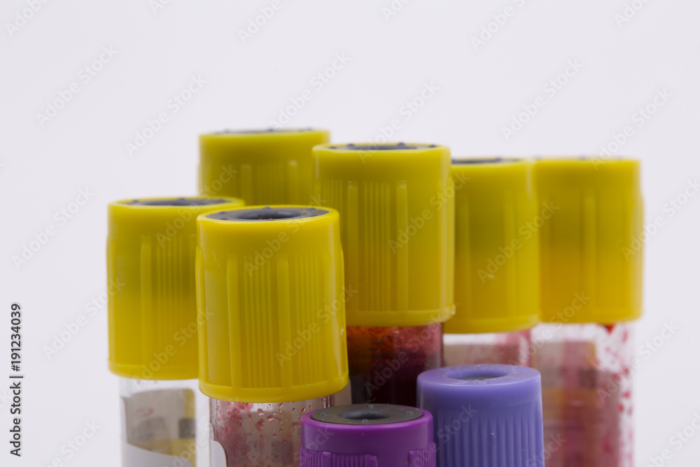 blood test tubes white background Stock Photo | Adobe Stock