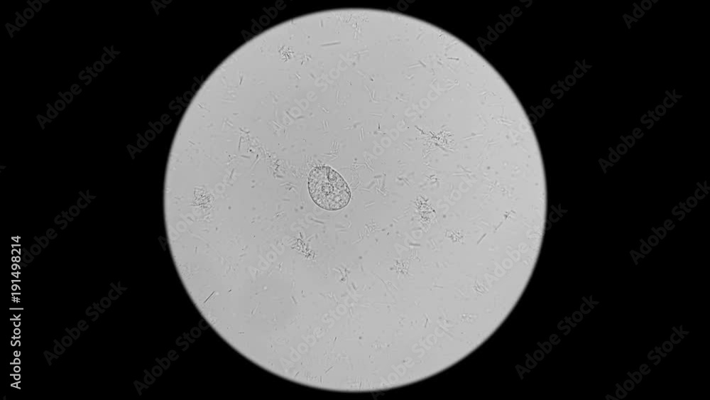 colony of bacteria-cadaveric fingers under the microscope Stock ビデオ ...