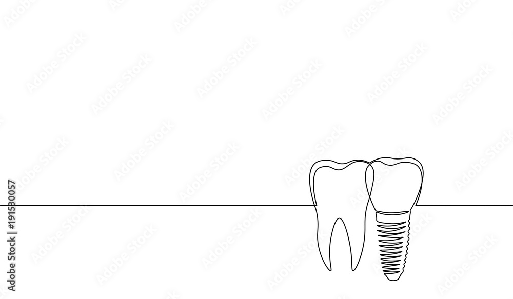 Single continuous line art anatomical human tooth silhouette implant ...