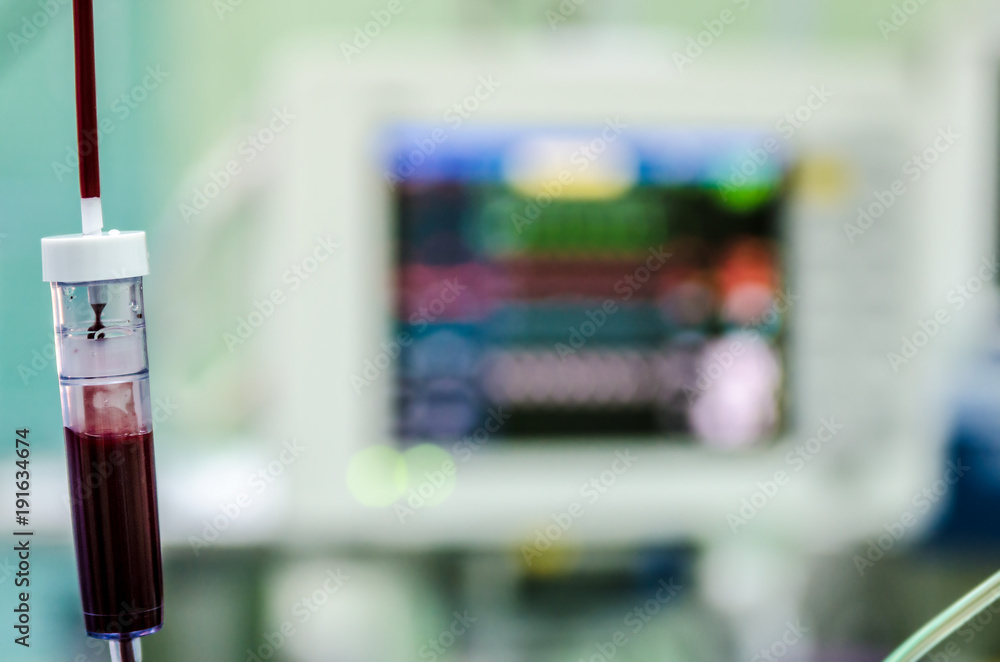 Blood in a dropper for transfusion during surgery. In the background, a ...