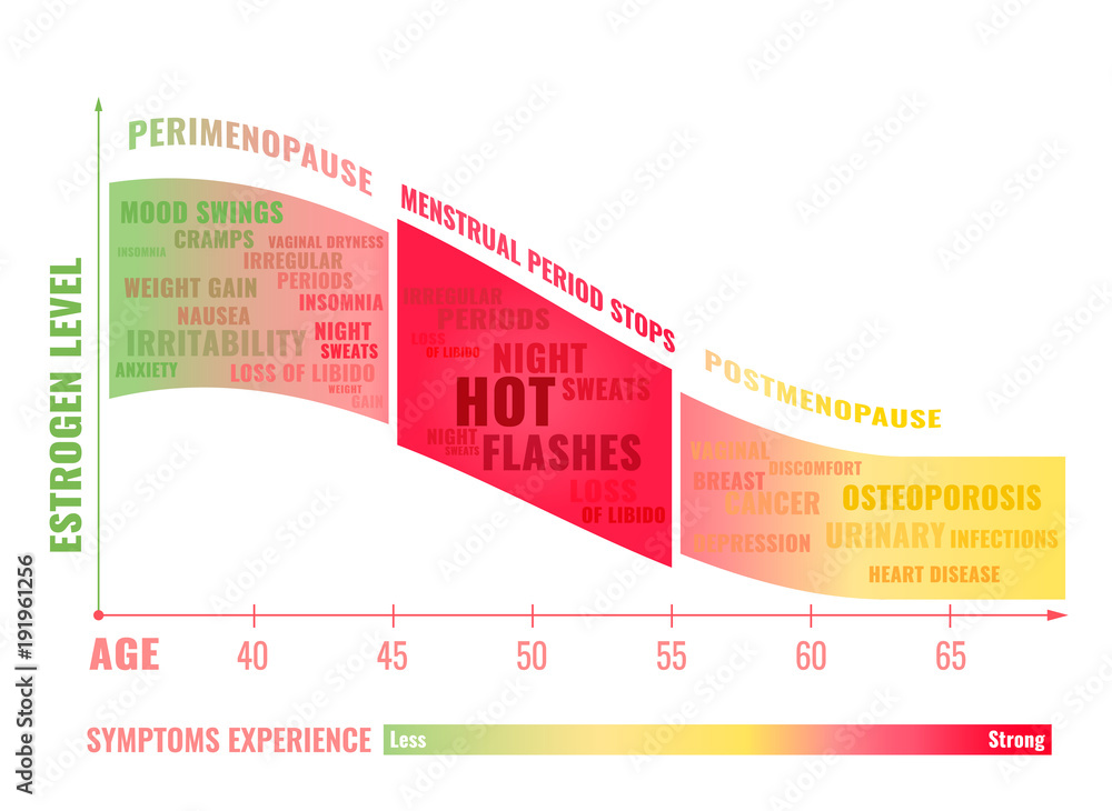 Poster Stages of Menopause Infographic – Wall Art | UkPosters