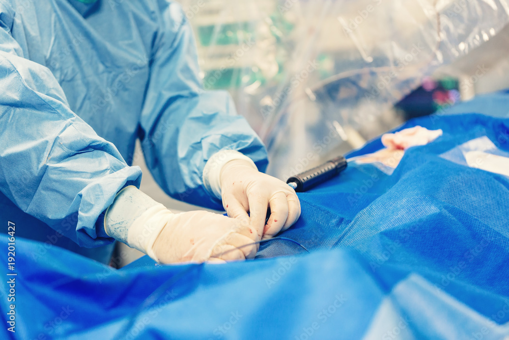 Foto de Minimally invasive cardiology transcatheter closure treatment ...