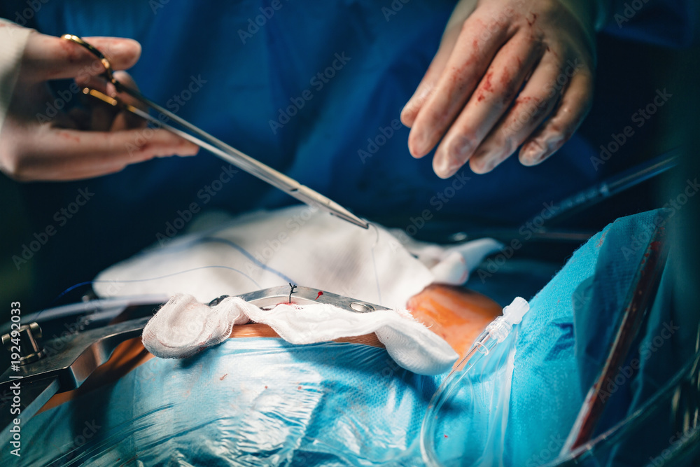 Team of surgeons in operating room. Needle holder or a needle driver in ...