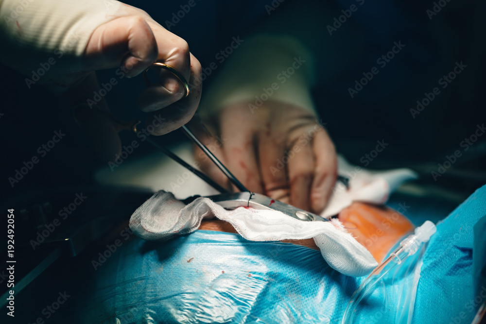 Foto de Team of surgeons in operating room. Needle holder or a needle ...