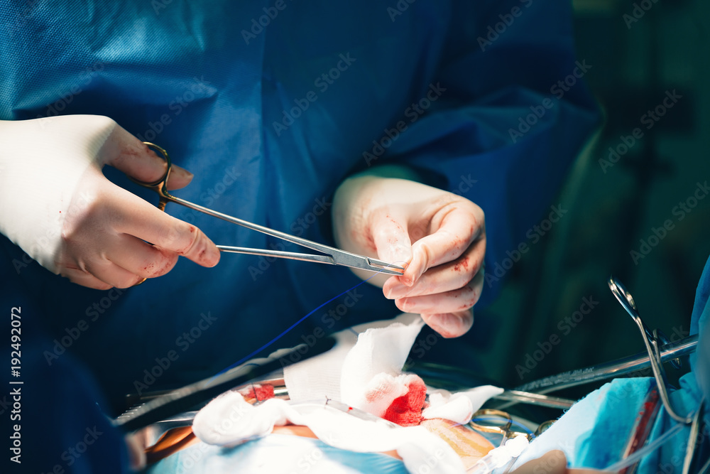 Needle holder or a needle driver in doctor's hand, a surgical ...