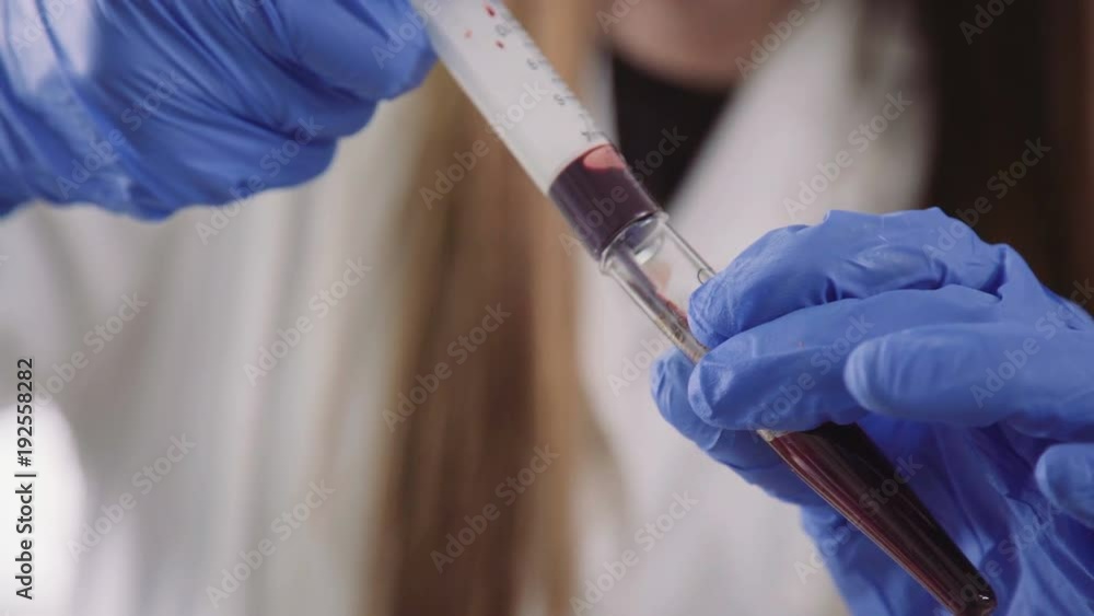 Hands in sterile blue gloves hold a test tube with the blood of a rat ...