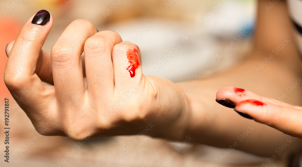 Blood on the arm from a cut with a knife Stock Photo | Adobe Stock