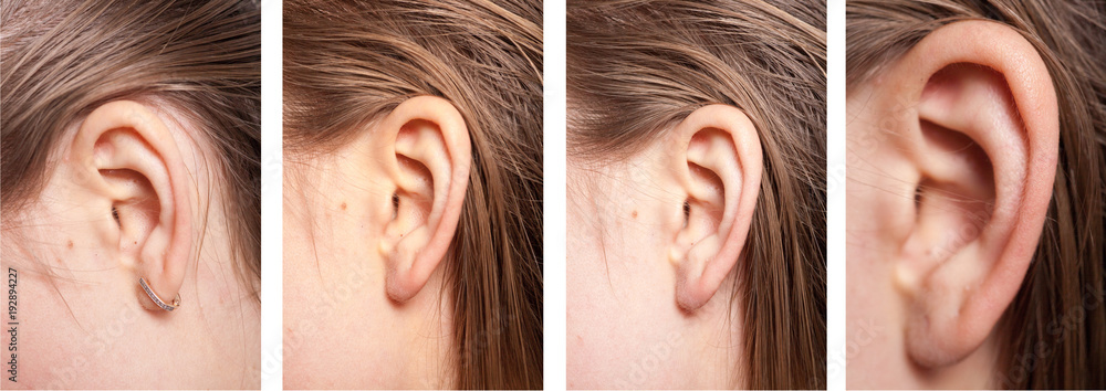 ear of a young healthy girl Detail of the head with female human ear ...