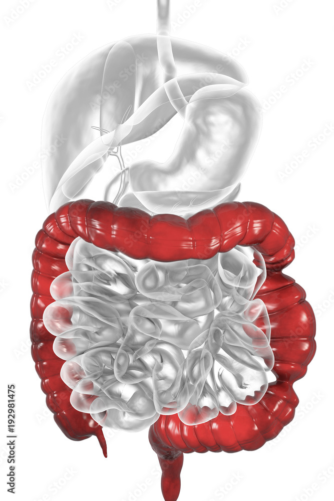 Irritable bowel syndrome IBS medical concept, 3D illustration showing ...