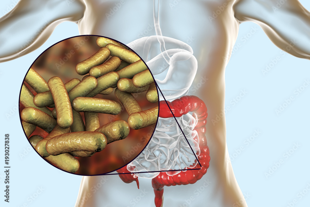 Rod-shaped bacteria Shigella which cause food-borne infection ...