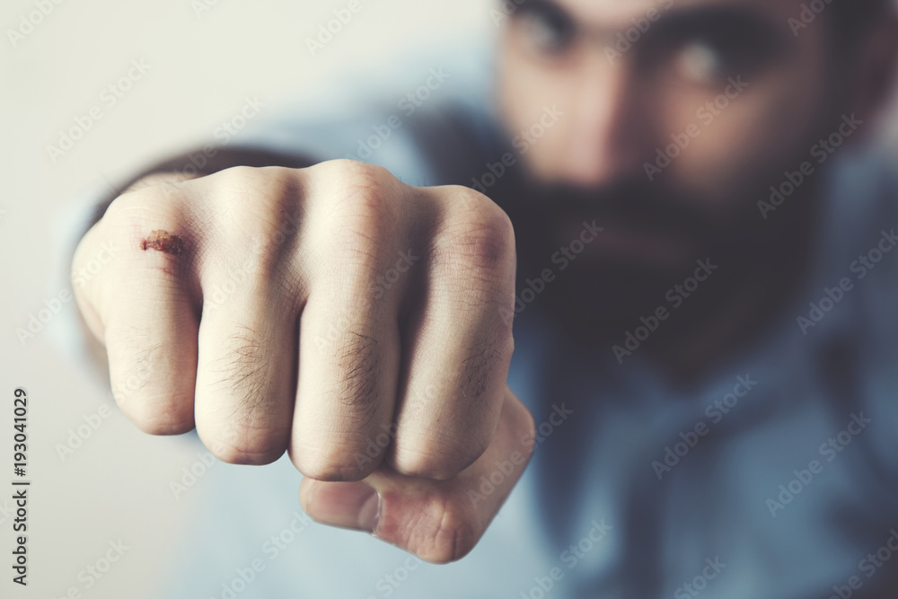 angry man fist hit Stock Photo | Adobe Stock