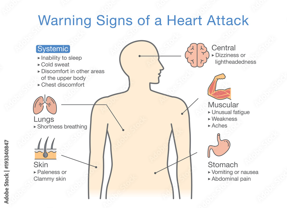 Diagram about warning signs of a heart attack. Illustration about ...