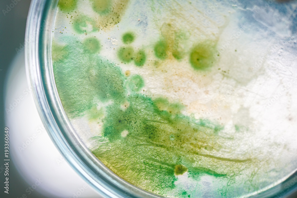 Colony of blue green algae in culture medium plate. Stock Photo | Adobe ...
