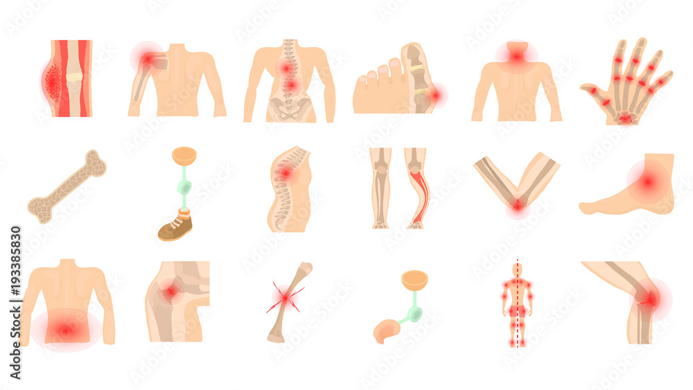 Human bones icon set, cartoon style Stock Vector | Adobe Stock