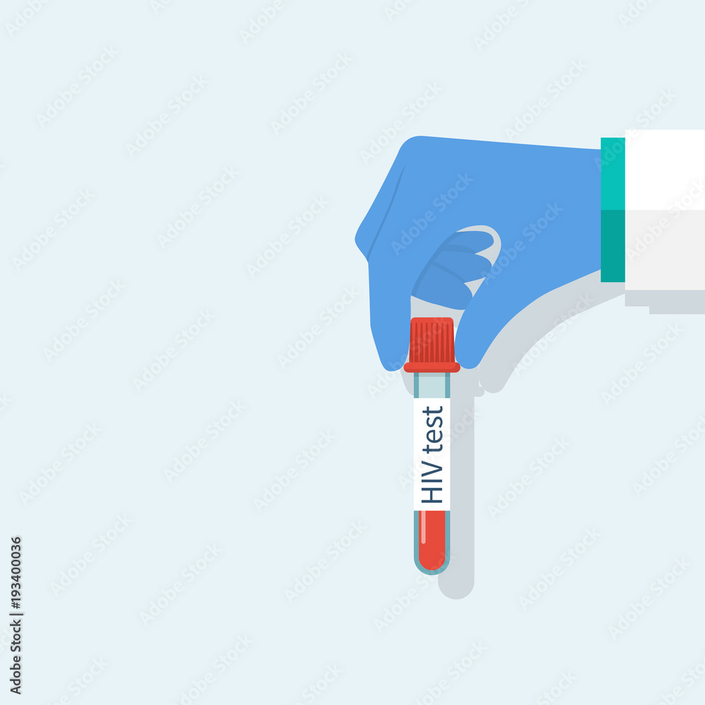 Doctors hands holding blood sample in glass tube for HIV test. World ...