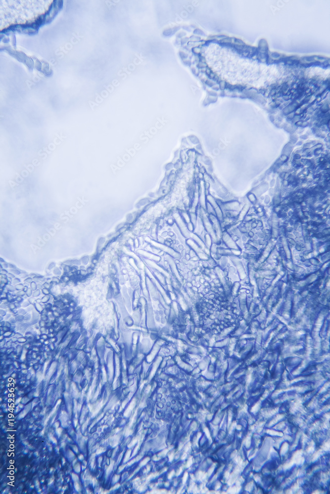 Mold at the microscope Stock Photo | Adobe Stock