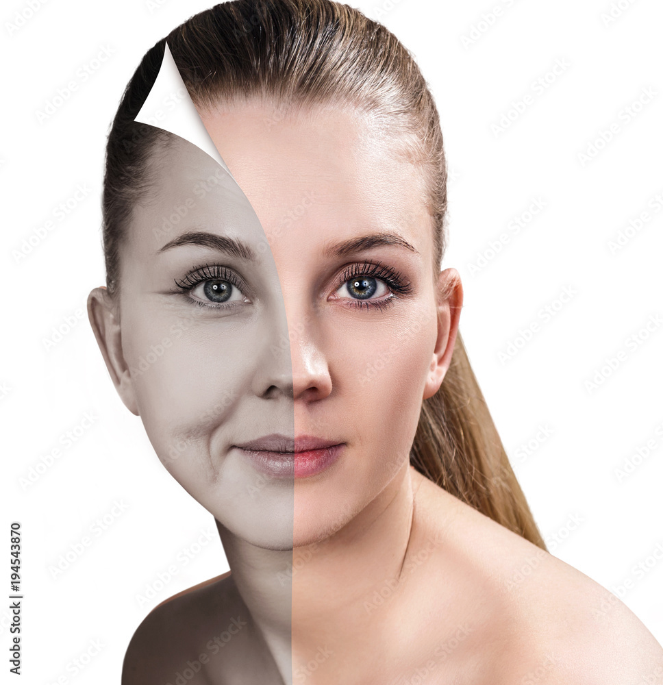 Woman's face before and after rejuvenation. Stock Photo | Adobe Stock
