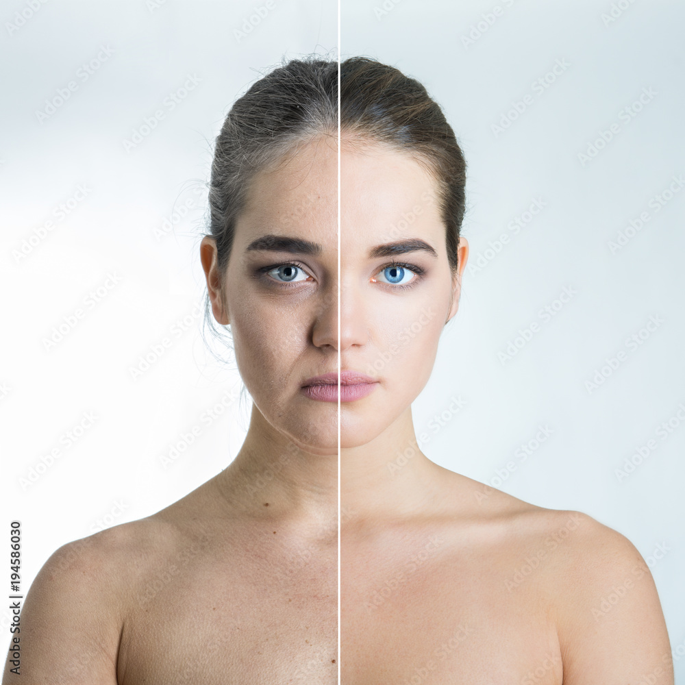 Anti-aging concept, portrait of beautiful woman with problem and clean ...