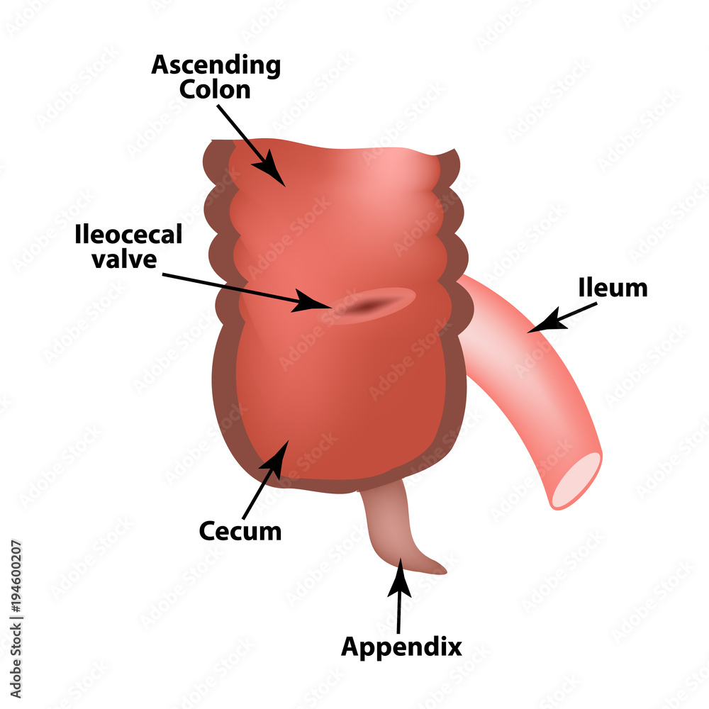 Ileocecal angle. Ileocecal valve. Bauginiev s damper. The ileum, the ...