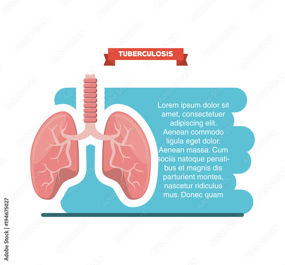 Tuberculosis infographic design with lungs icon over white background ...