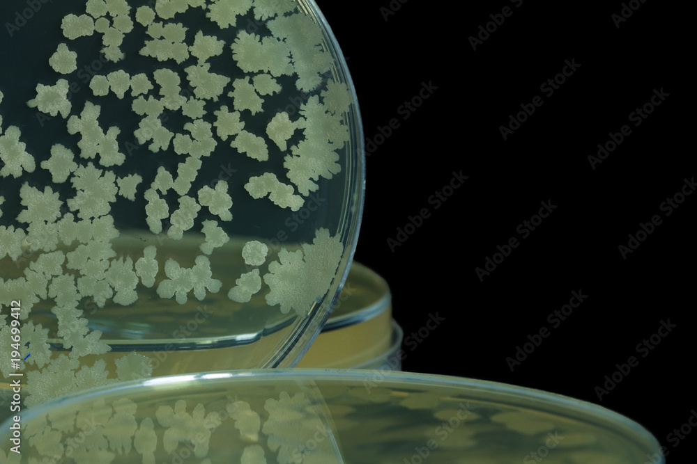 Bacillus sp. on TSA agar plate . Colony bacteria on agar plate ...