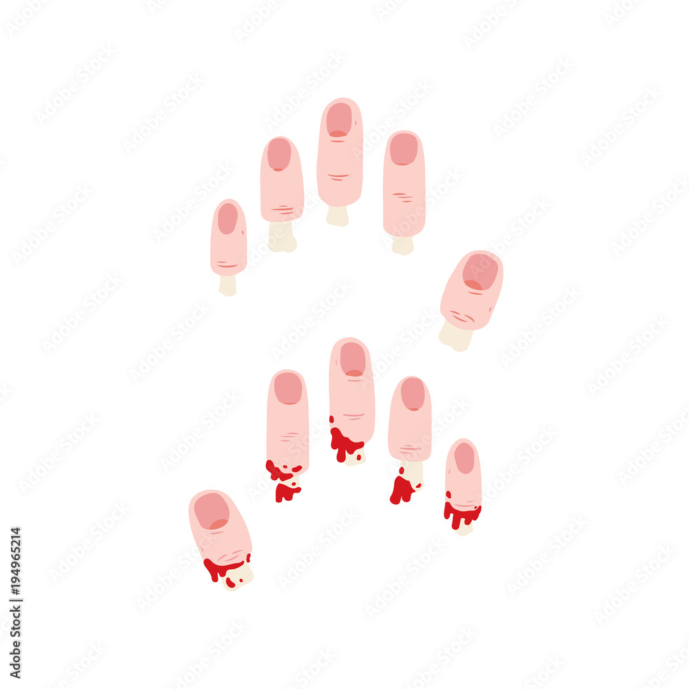 Hand drawn vector illustration of finger cut off with exposed bone ...