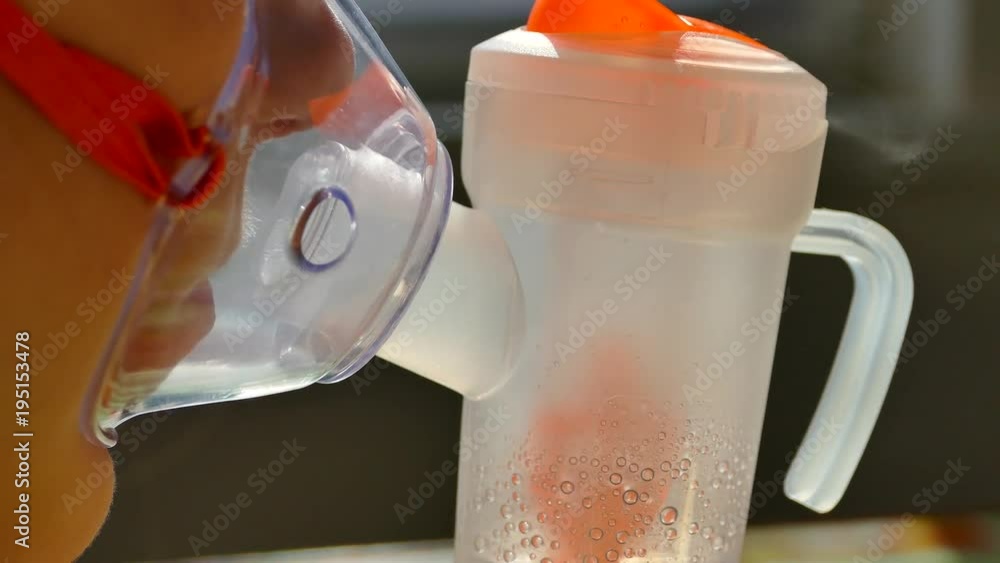 The baby breathes through the inhaler. Mask inhaler on the face of the ...