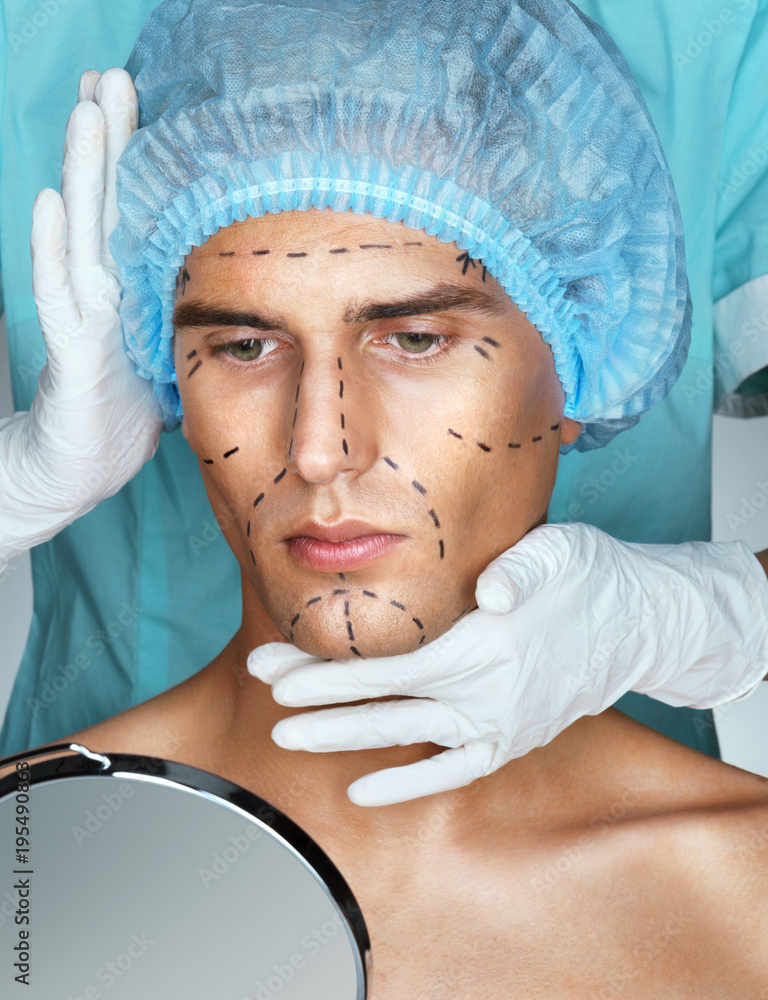 Beautiful Man with perforation lines on his face before plastic surgery ...