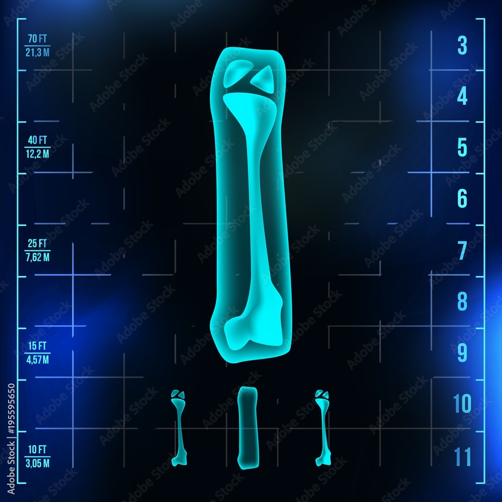 I Letter Vector. Capital Digit. Roentgen X-ray Font Light Sign. Medical ...