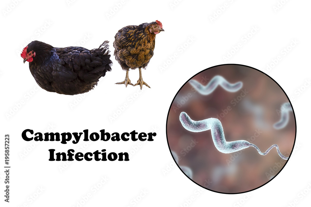 Chicken meat as the source of Campylobacter infection, medical concept ...