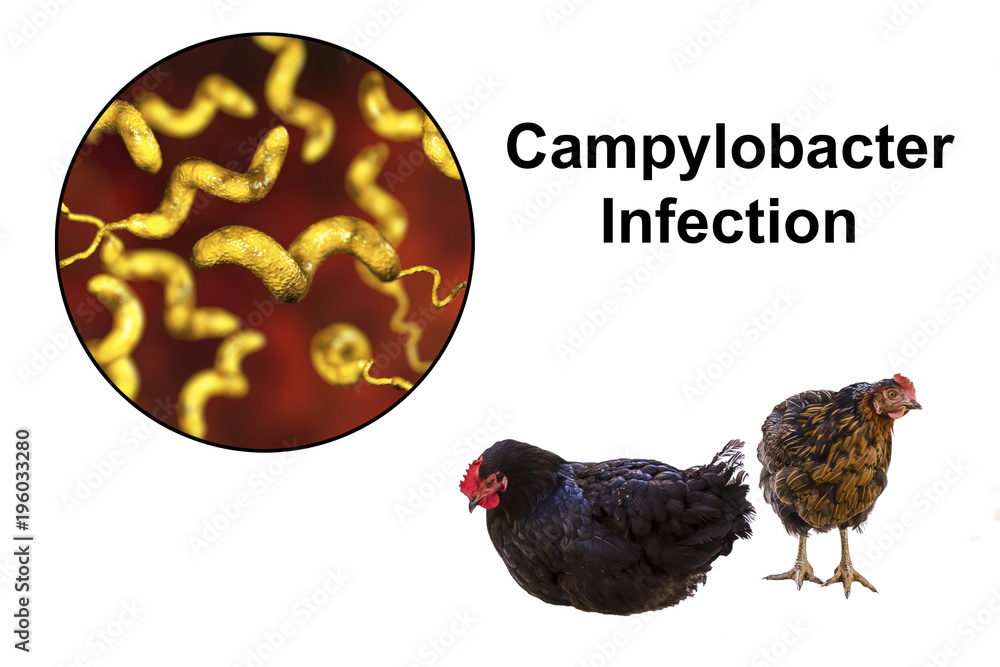 Chicken meat as the source of Campylobacter infection, medical concept ...