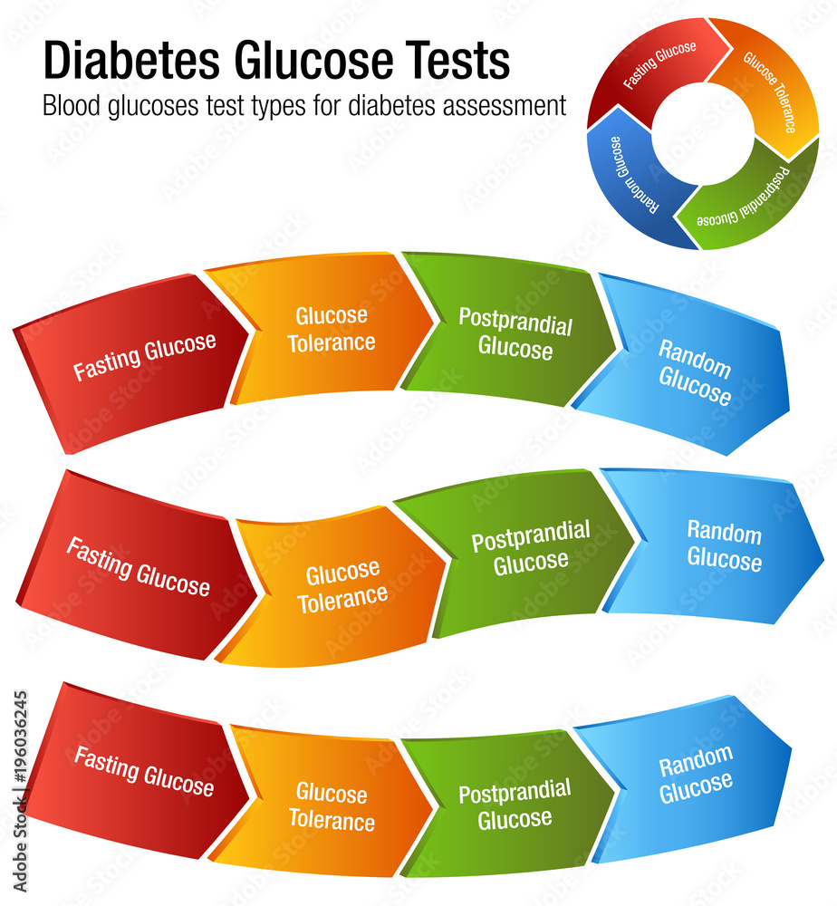 Photo & Art Print Diabetes Blood Glucose Test Types Chart, John Takai