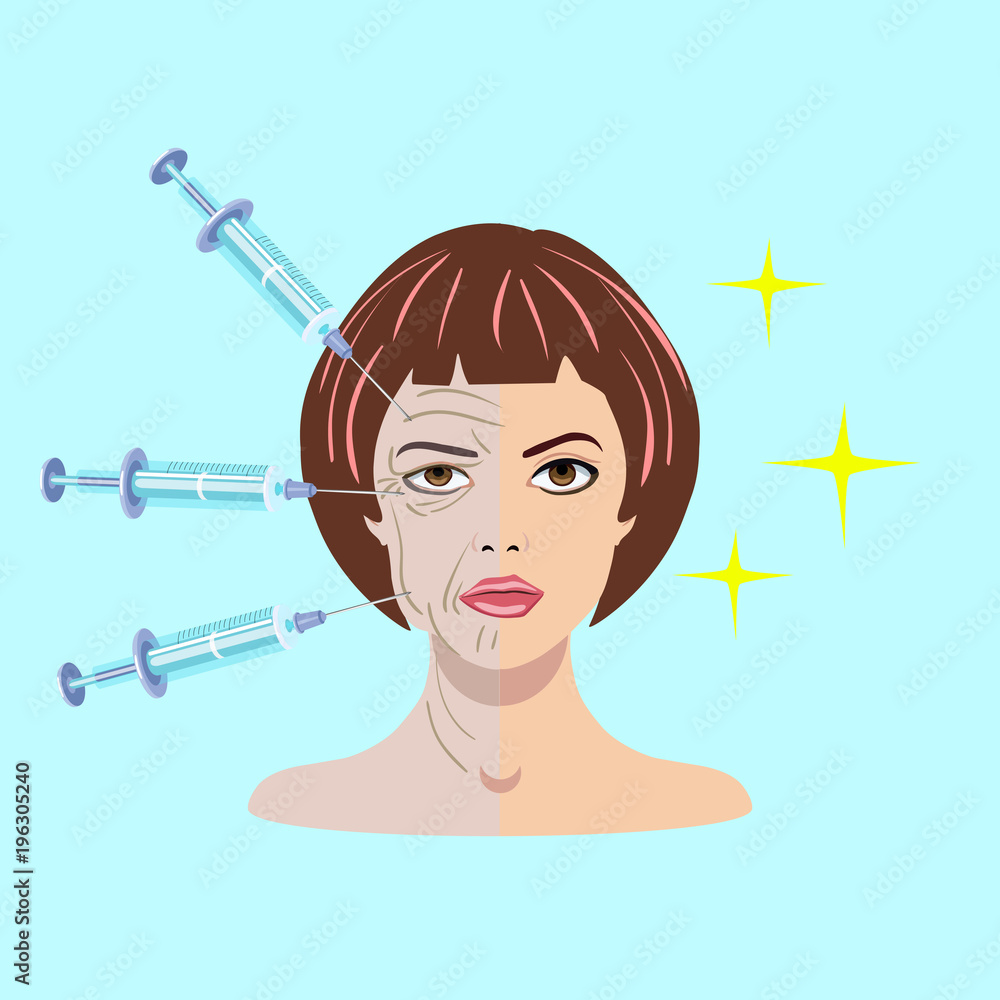 Vector illustration with dermal filler process on the blue background ...