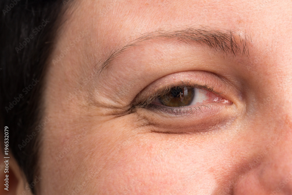 Wrinkles and crow's feet on woman eye Stock Photo | Adobe Stock
