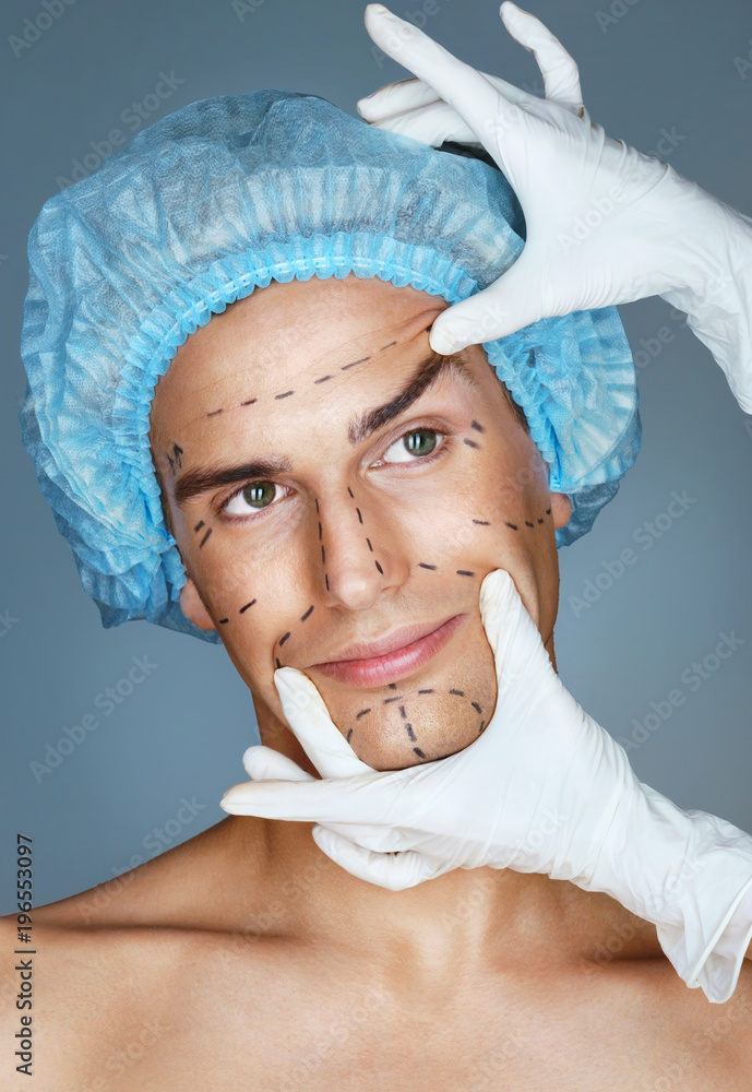 Doctor touches the man's face. Close up of male with correction lines ...