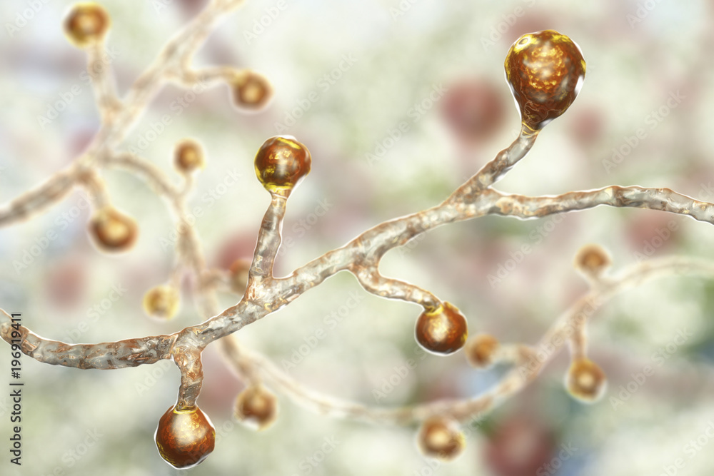 Blastomyces dermatitidis fungi, the causative agent of the disease ...