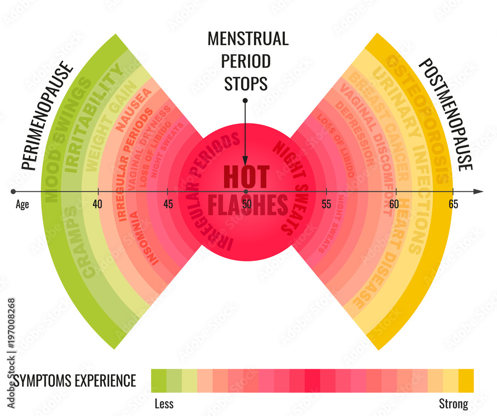 Poster Stages of Menopause Infographic – Wall Art | UkPosters