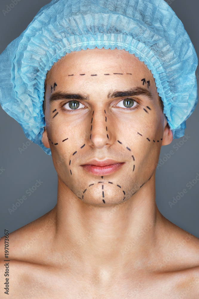 Handsome man in medical hat with pencil marks on skin for cosmetic ...