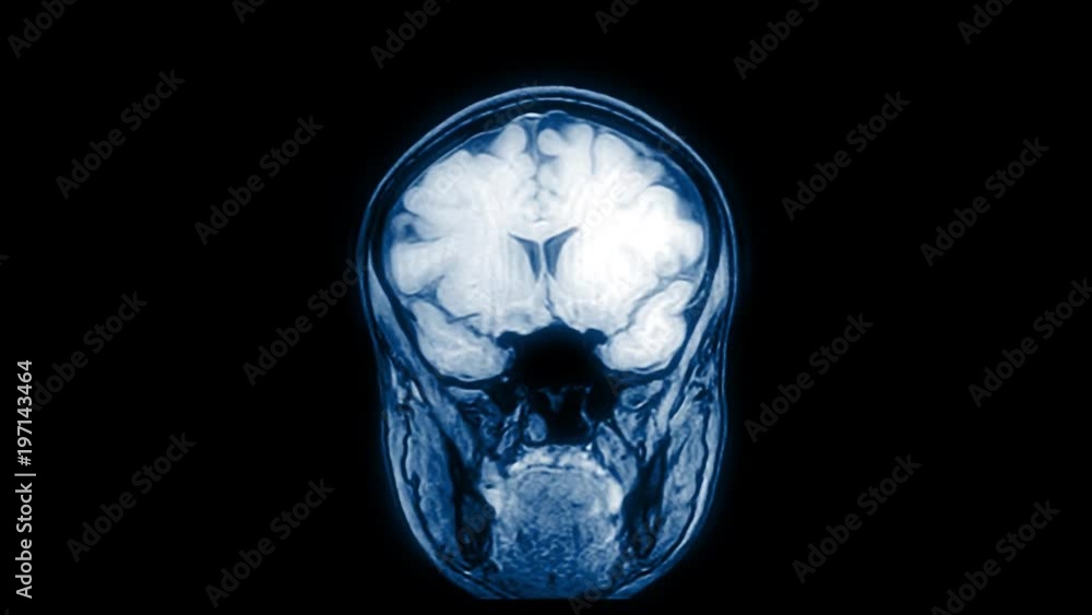 Computed medical tomography MRI upscaled scan of healthy young female ...