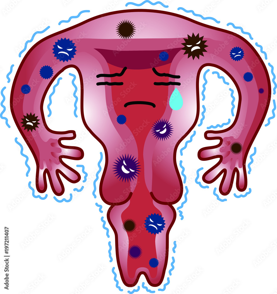 Unhealthy Cervix