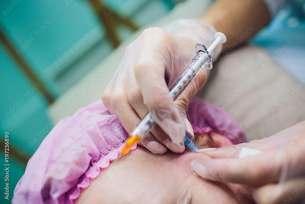 Professional holding the needle cannula on hand for piercing. Closeup ...
