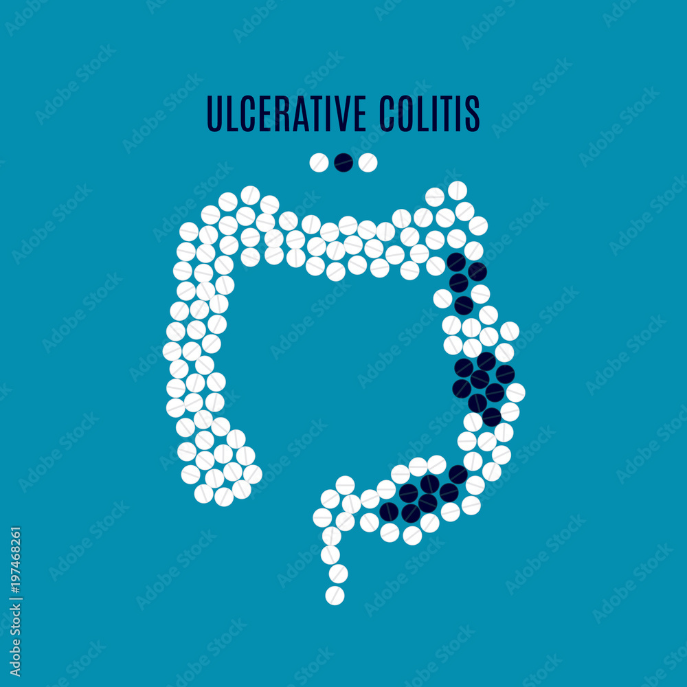 Ulcerative colitis awareness poster with intestine made of pills on ...