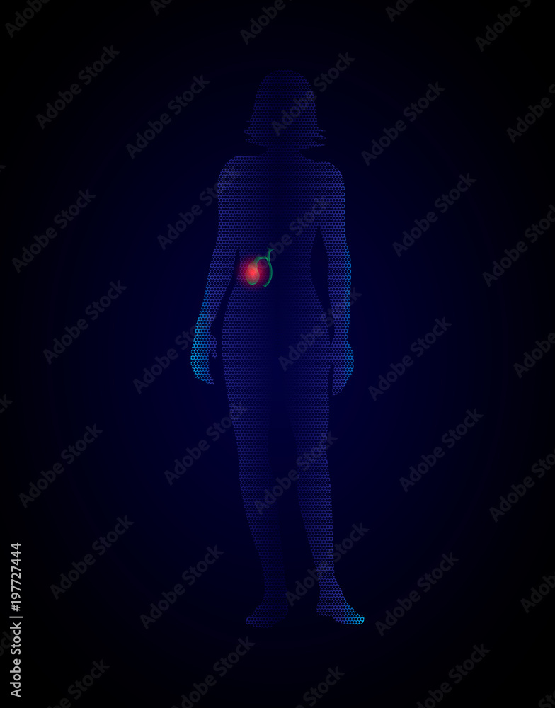 Vector x ray gallbladder infographics. silhouette of a woman with a ...