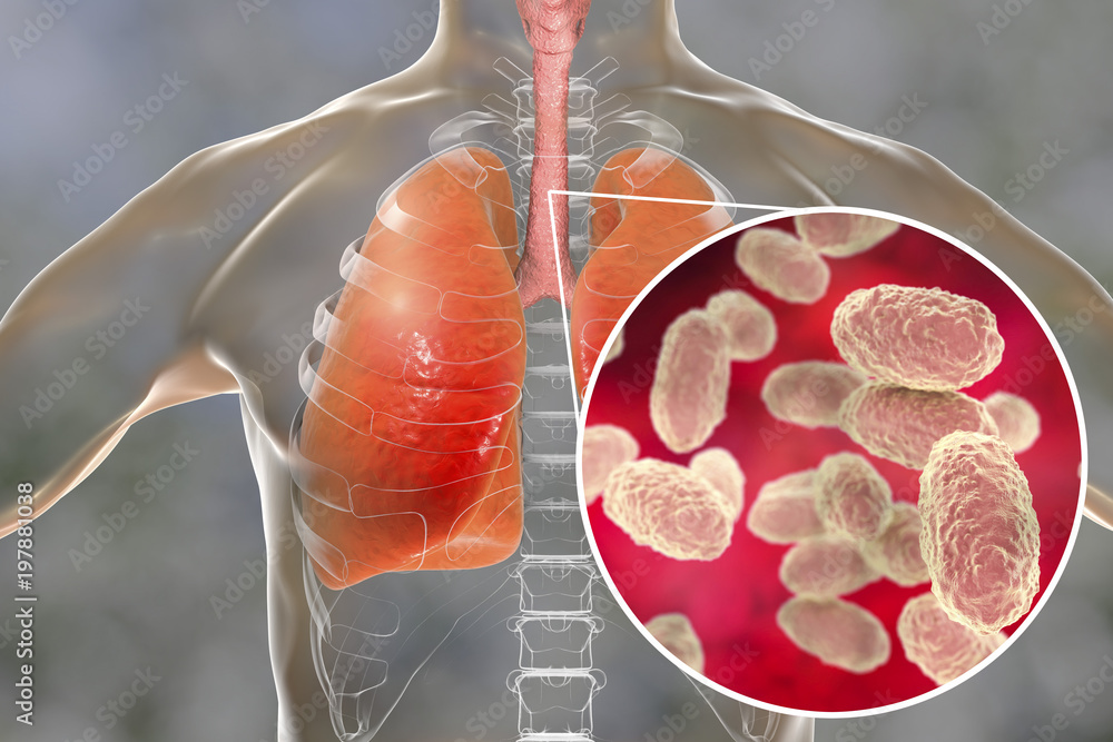 Whooping cough bacteria Bordetella pertussis in human airways Stock ...