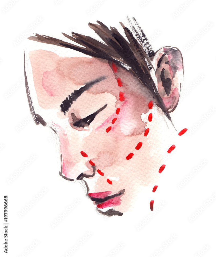 Portrait of sad Asian woman with scheme for plastic surgery drawn on ...