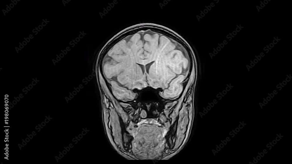 Computed medical tomography MRI upscaled scan of healthy young female ...