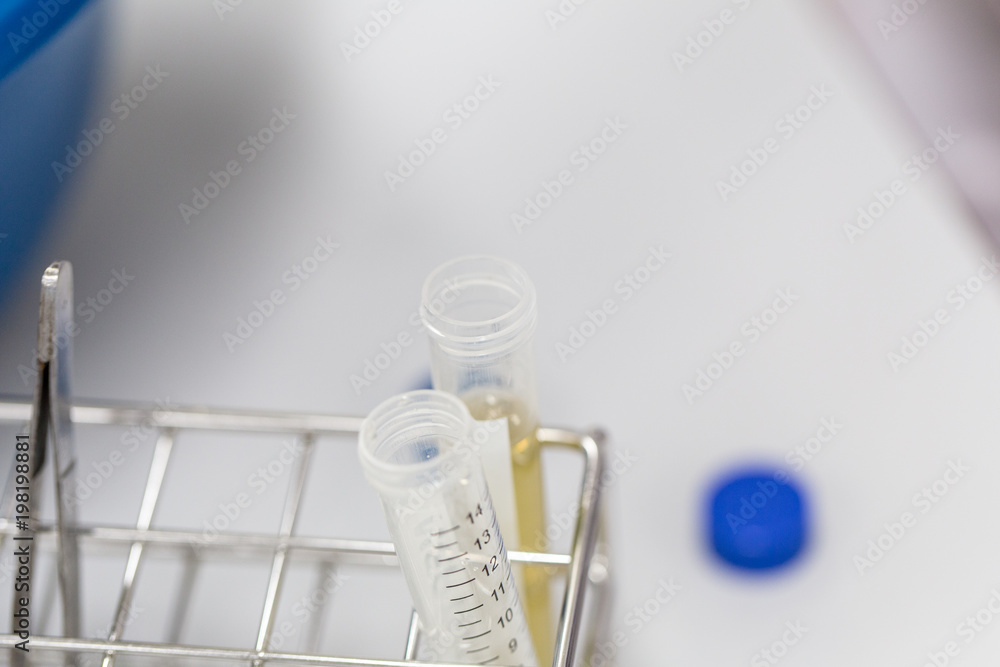 Finding parasites in feces in laboratory. Stock Photo | Adobe Stock